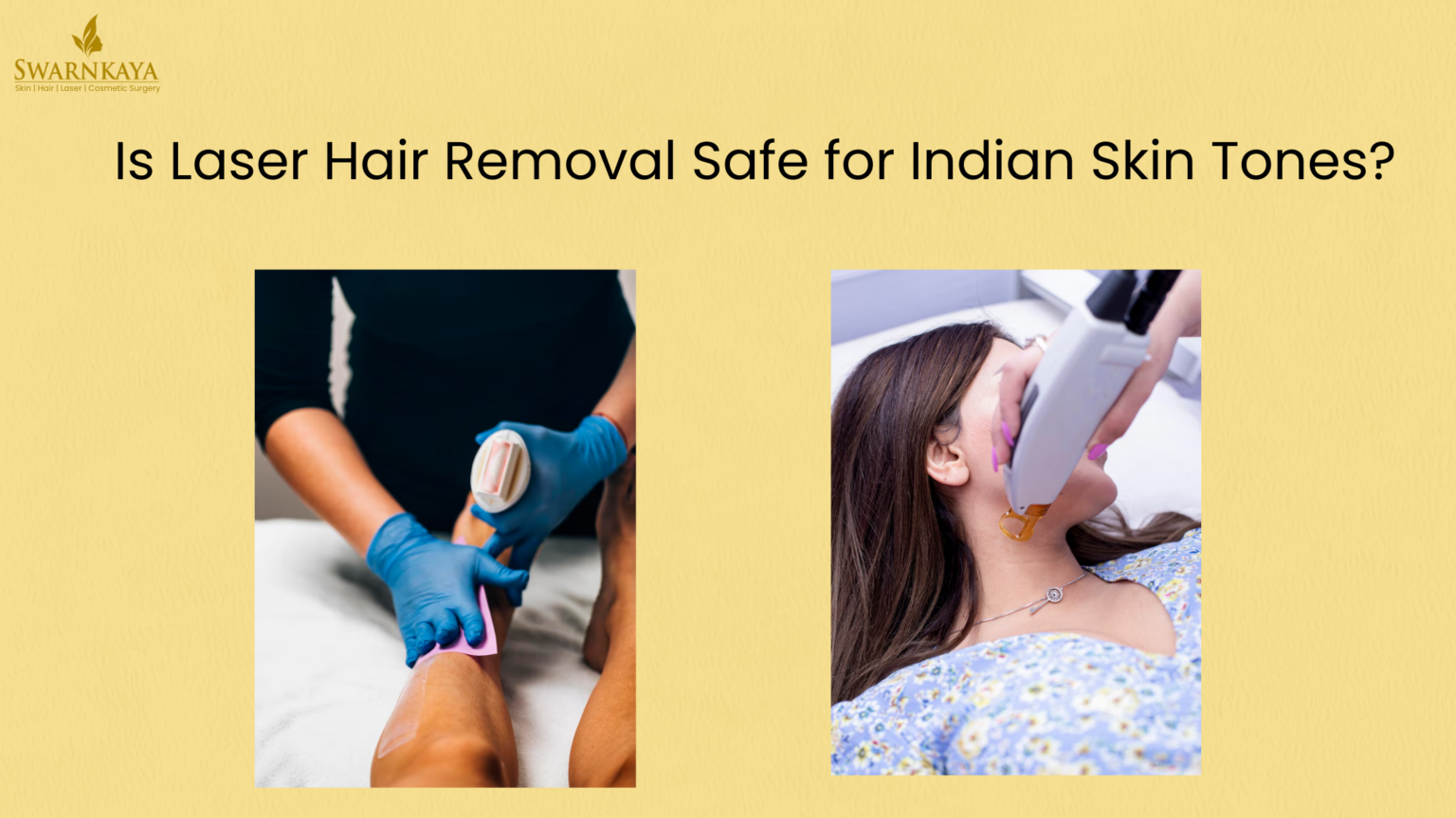 Is Laser Hair Removal Safe for Indian Skin? | Swarnkaya